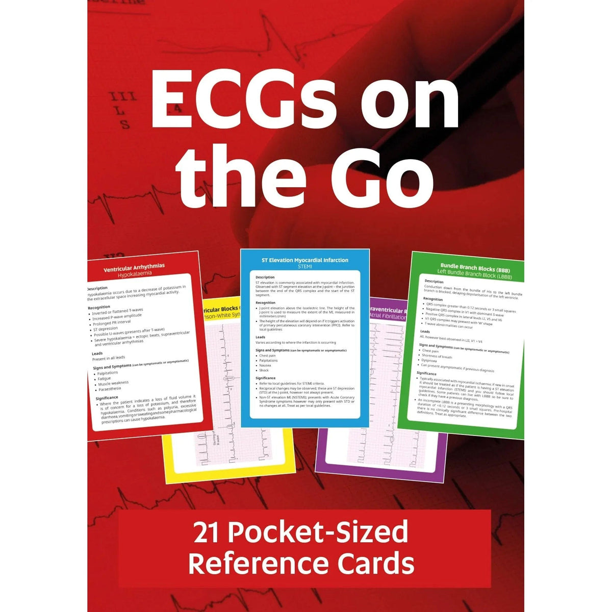 ECGs On The Go - 21 Pocket-Sized Reference Cards - Paramedic Shop